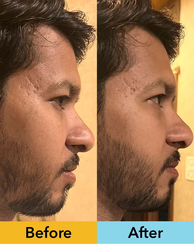 Patchy Beard Fix – Instant Solution for Beards – Rise for Men